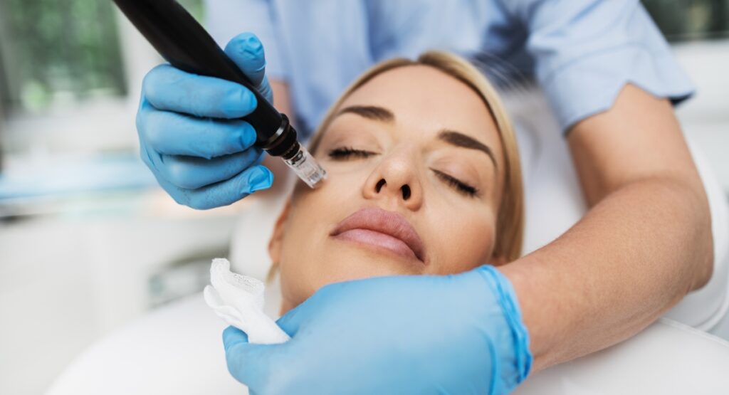 Microneedling | Evolution Of Her Beauty